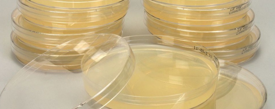 Cherwell | The top 5 tips to producing agar plates like an expert